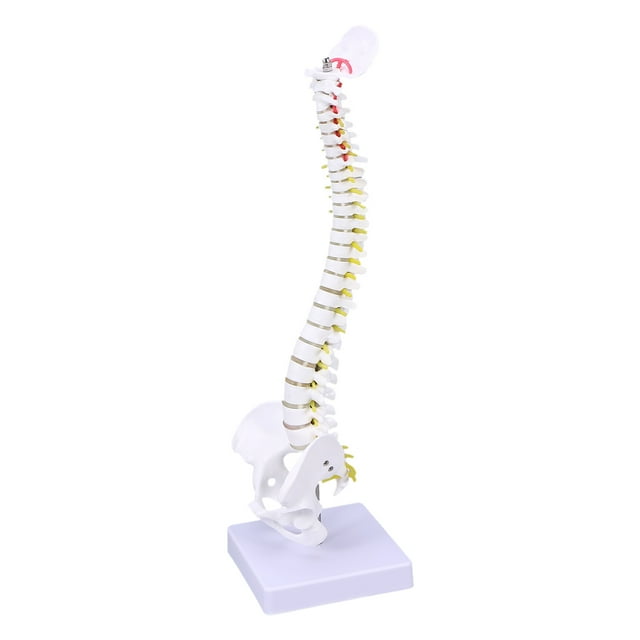 Sensethe Human Lumbar Disc Herniation Model Spine Model Lumbar ...
