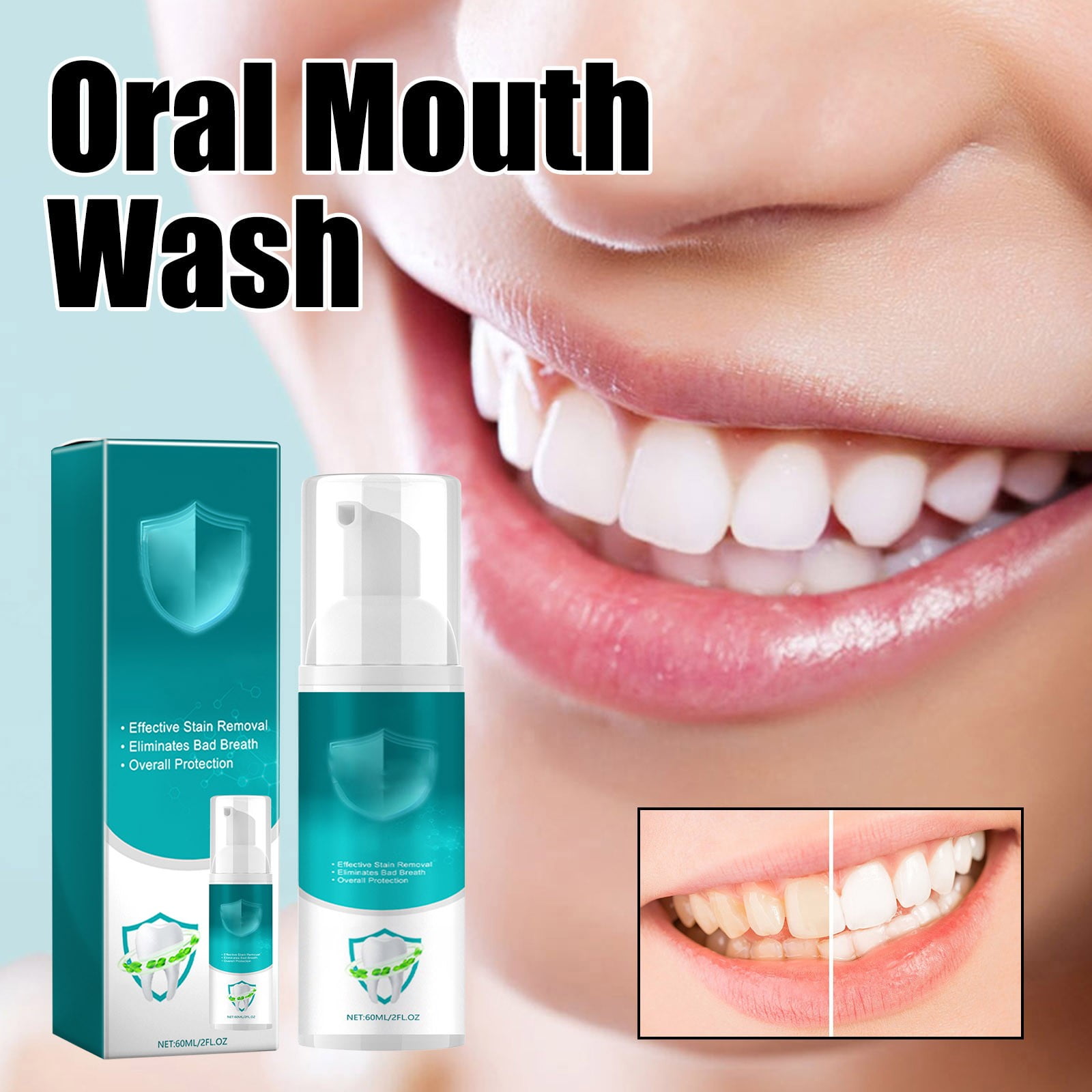 No Sensitivity Teeth Whitening Gel Effective Teeth Whitener Cream Can ...