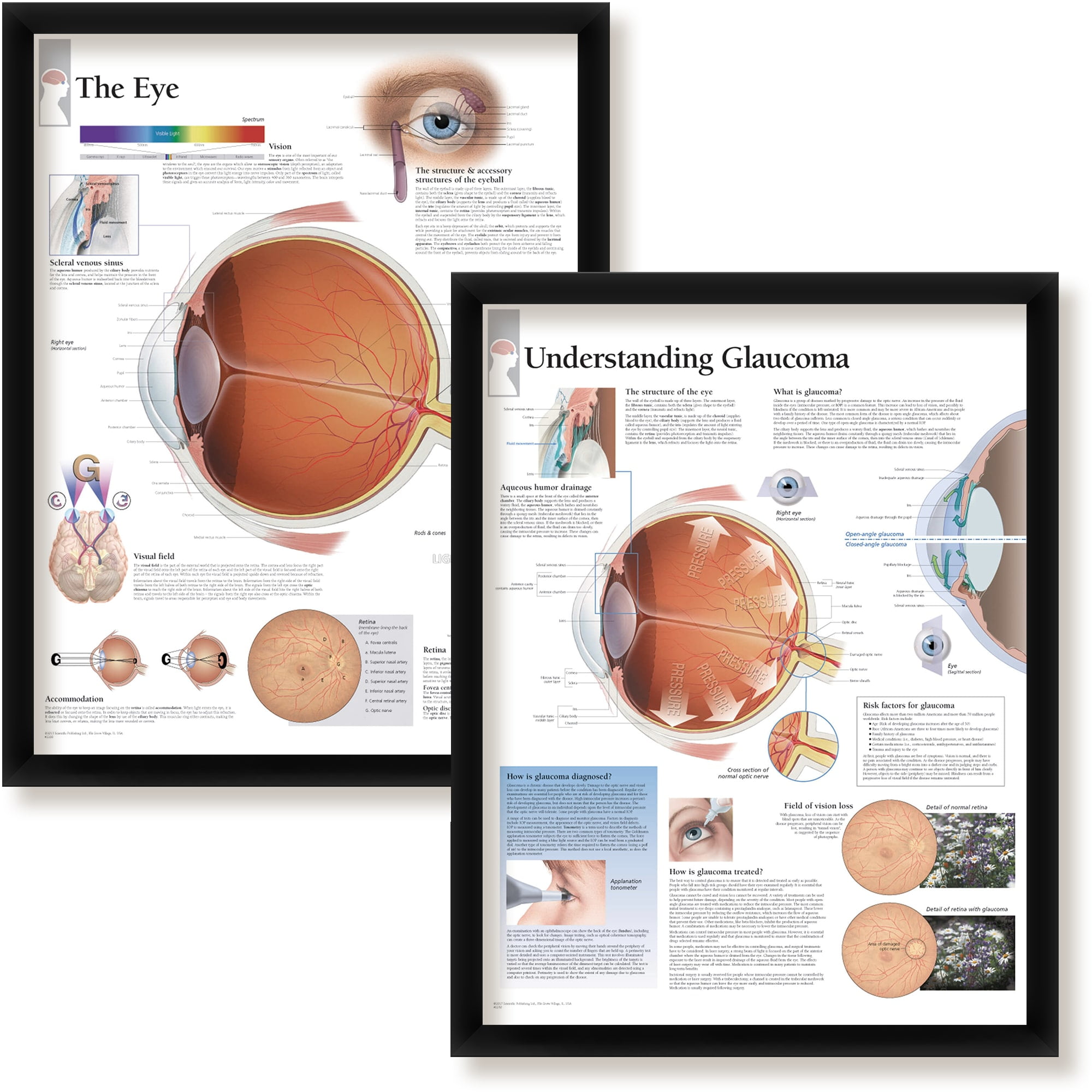 Set of 2 Framed Medical Posters The Eye and Understanding Glaucoma 22 ...