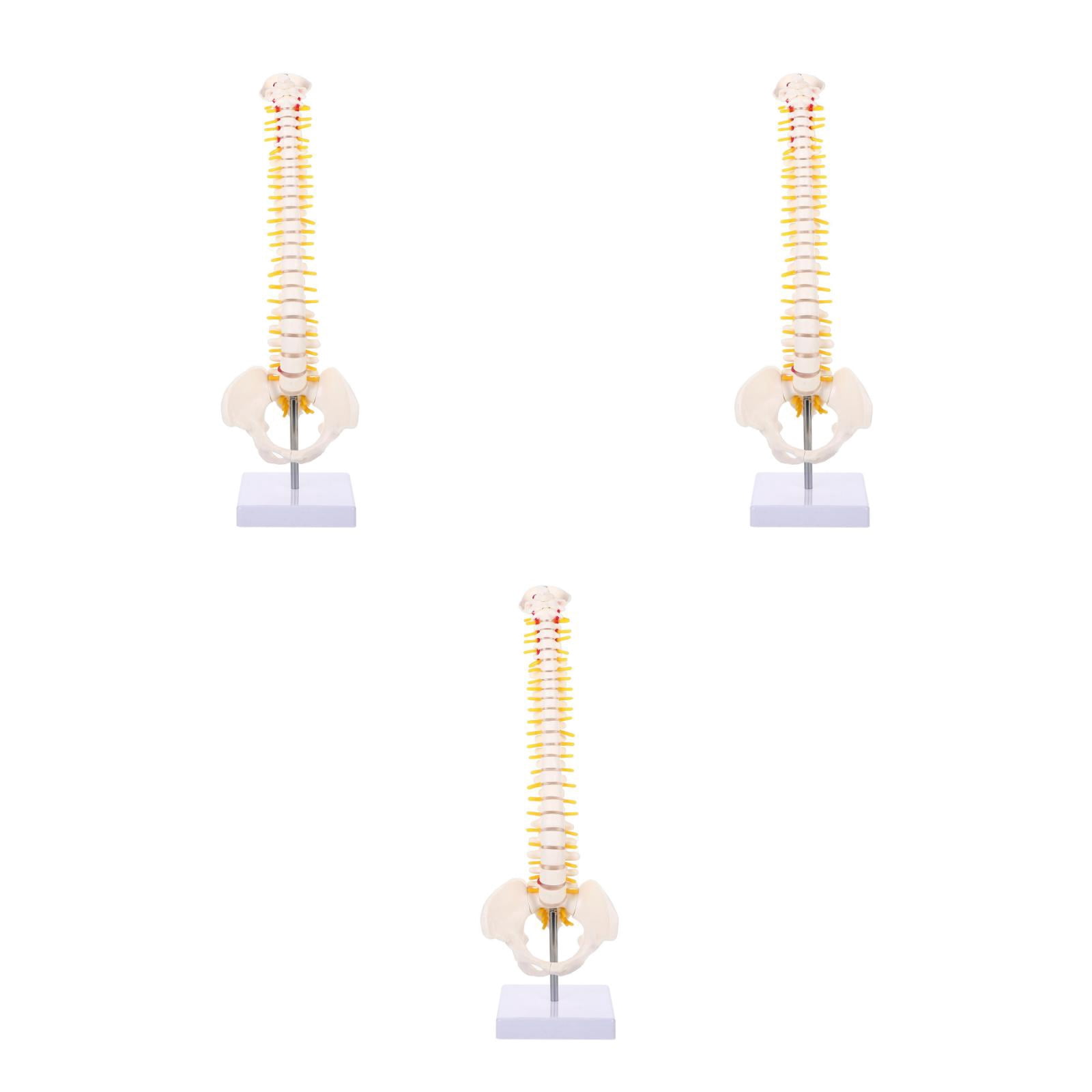Set of 3 Anatomy Poster Spine Skeleton Model Headbands Intervertebral ...
