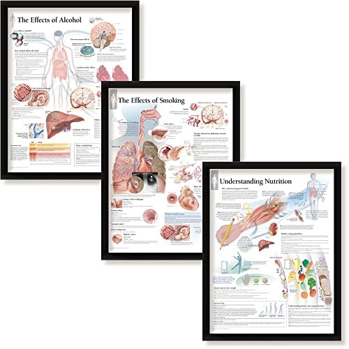 Set of 3 Framed Medical Posters The Effects of Alcohol The Effects of ...