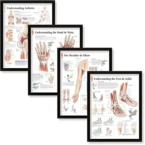 Set of 4 Framed Medical Posters Understanding Arthritis, Hand and Wrist ...