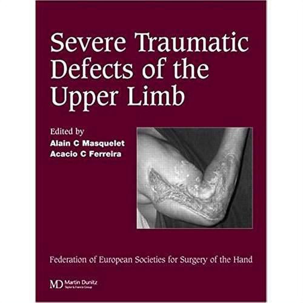 Severe Tramatic Defects of the Upper Limb: Published in association ...