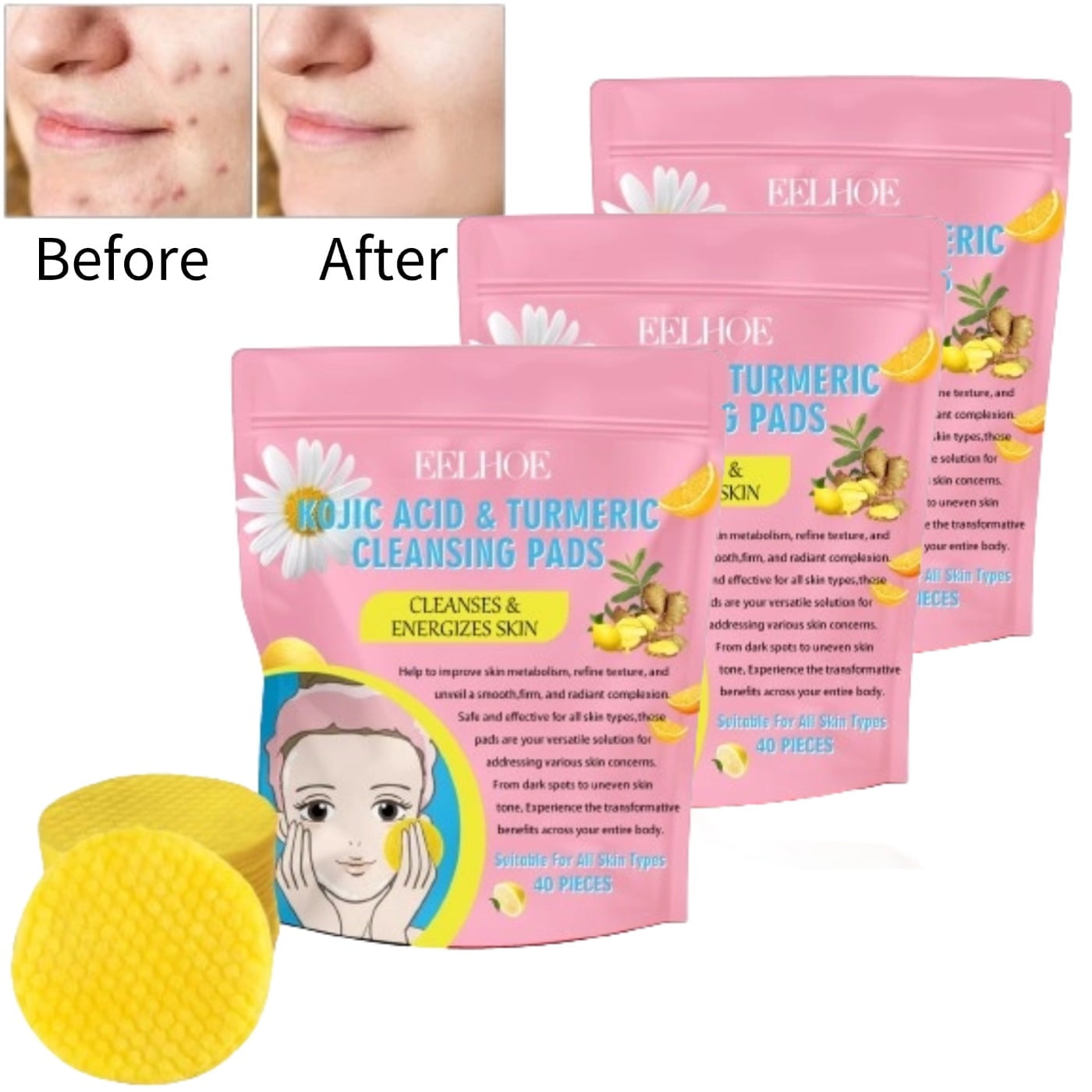Sfonq Beauty Kojic Acid Turmeric Cleansing Pads - Turmeric Cleansing ... Sfonq Beauty Kojic Acid Turmeric Cleansing Pads - Turmeric Cleansing ...