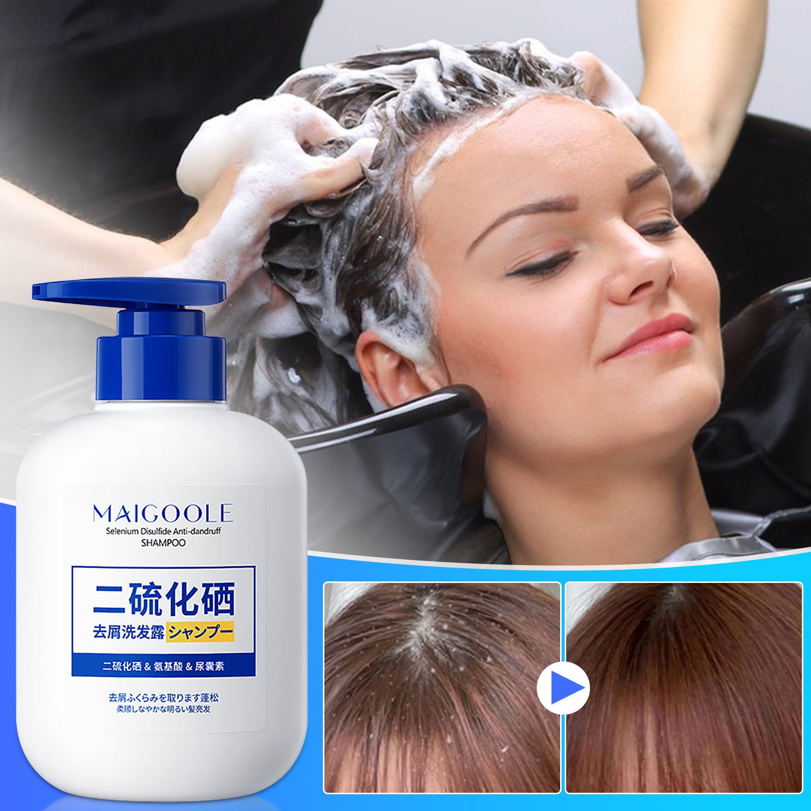Shampoo for Oily Hair Control | 300ml Scalp Cleansing & Dandruff ...