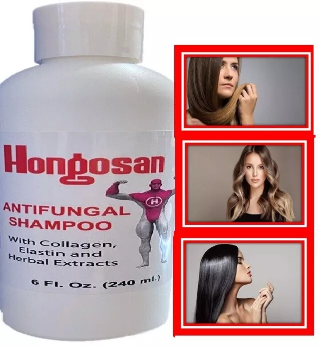 Shampoo hair druff antifungal Caspa Anticaspa Champu Psoriasis Cabello ...