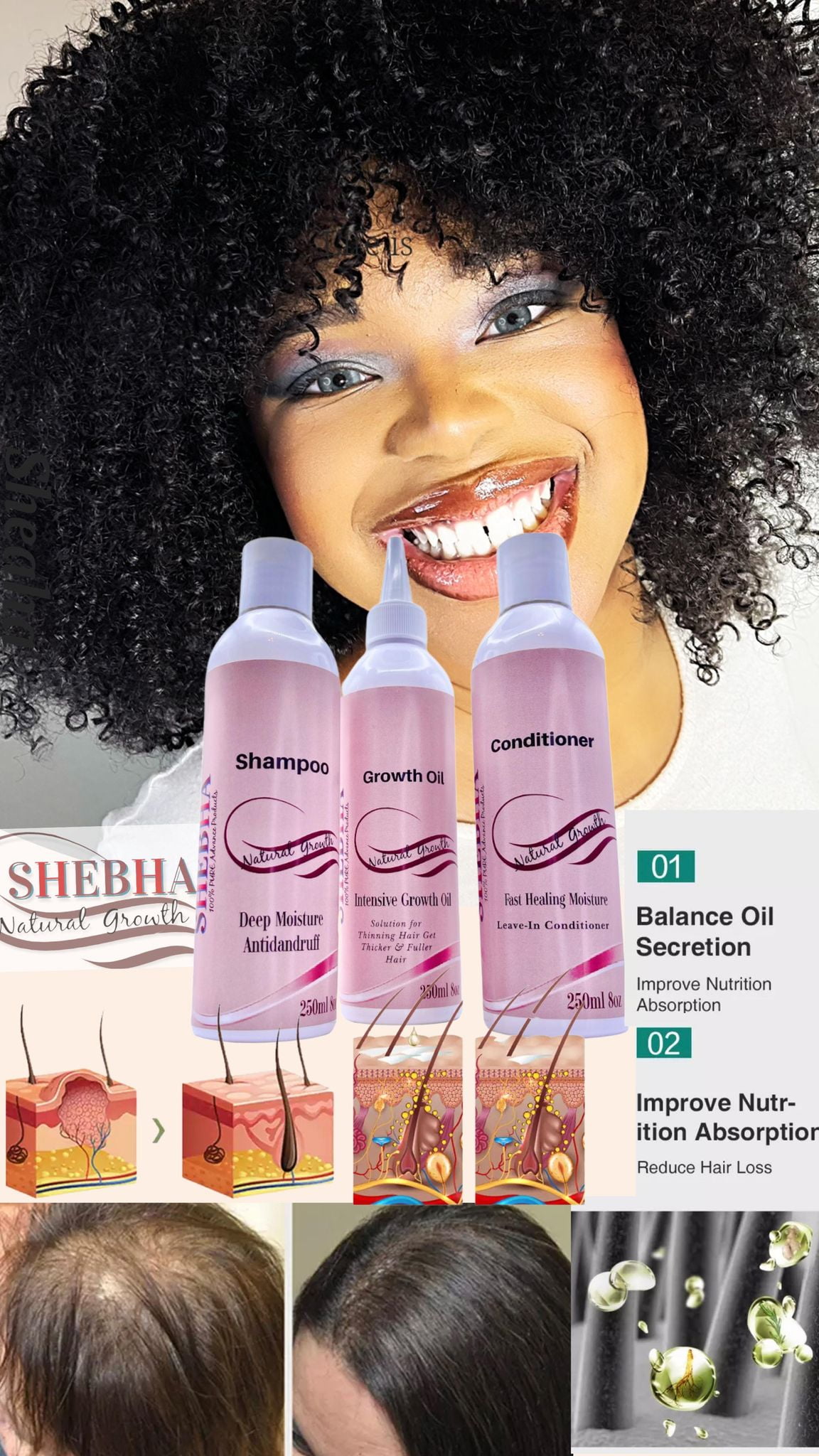 Shebha Complete Scalp Care Set: Deep Moisture Anti-Dandruff Shampoo ...