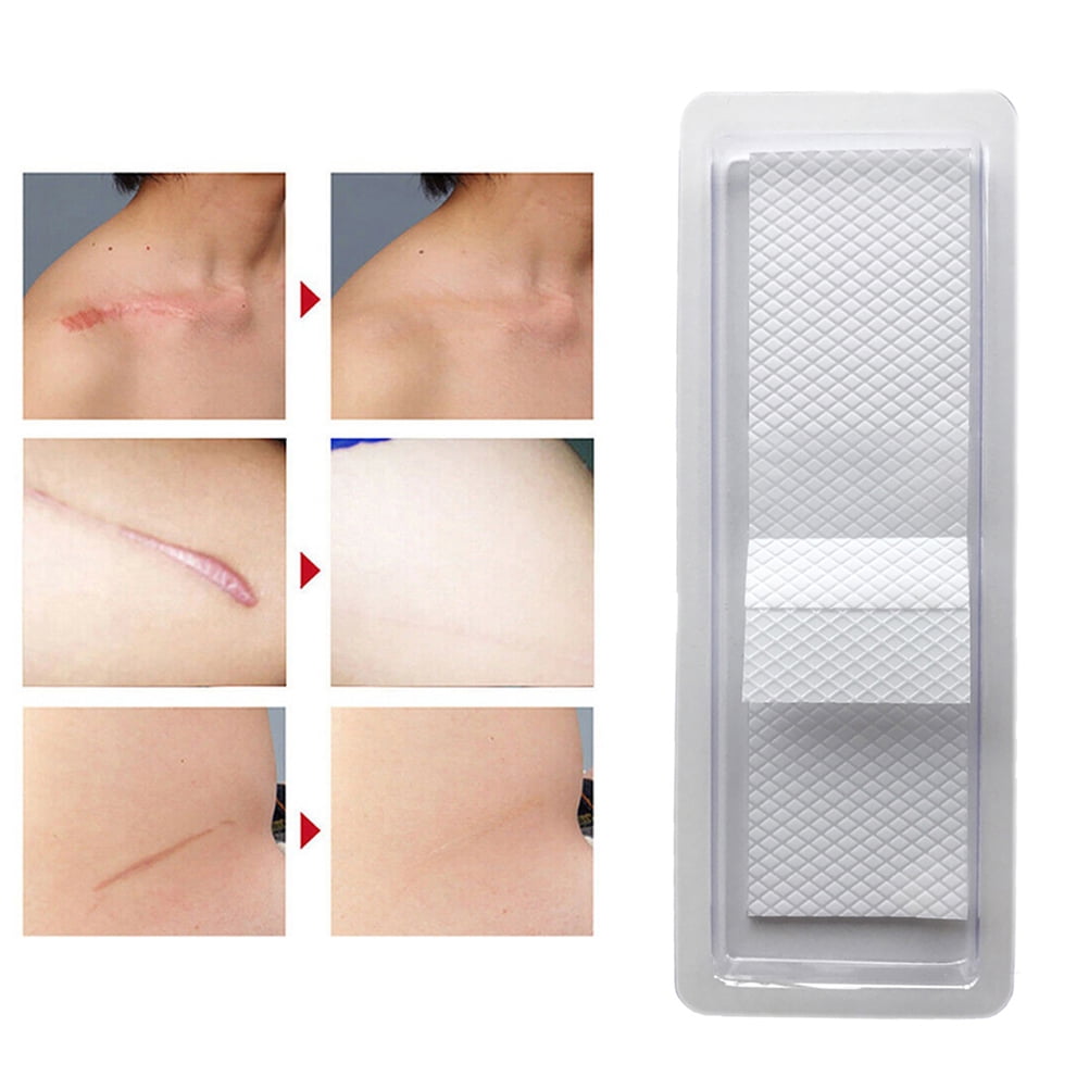 Silicone Removal Scar Patch Reusable Acne Gel Scar Remove Patch Trauma ...