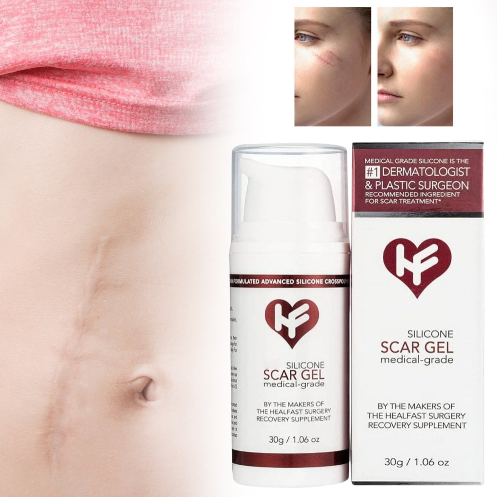 Silicone Scar Gel 30g,Silicone Scar Gel Scar Cream, Advanced Scar Gel for Surgical Scars, C ...