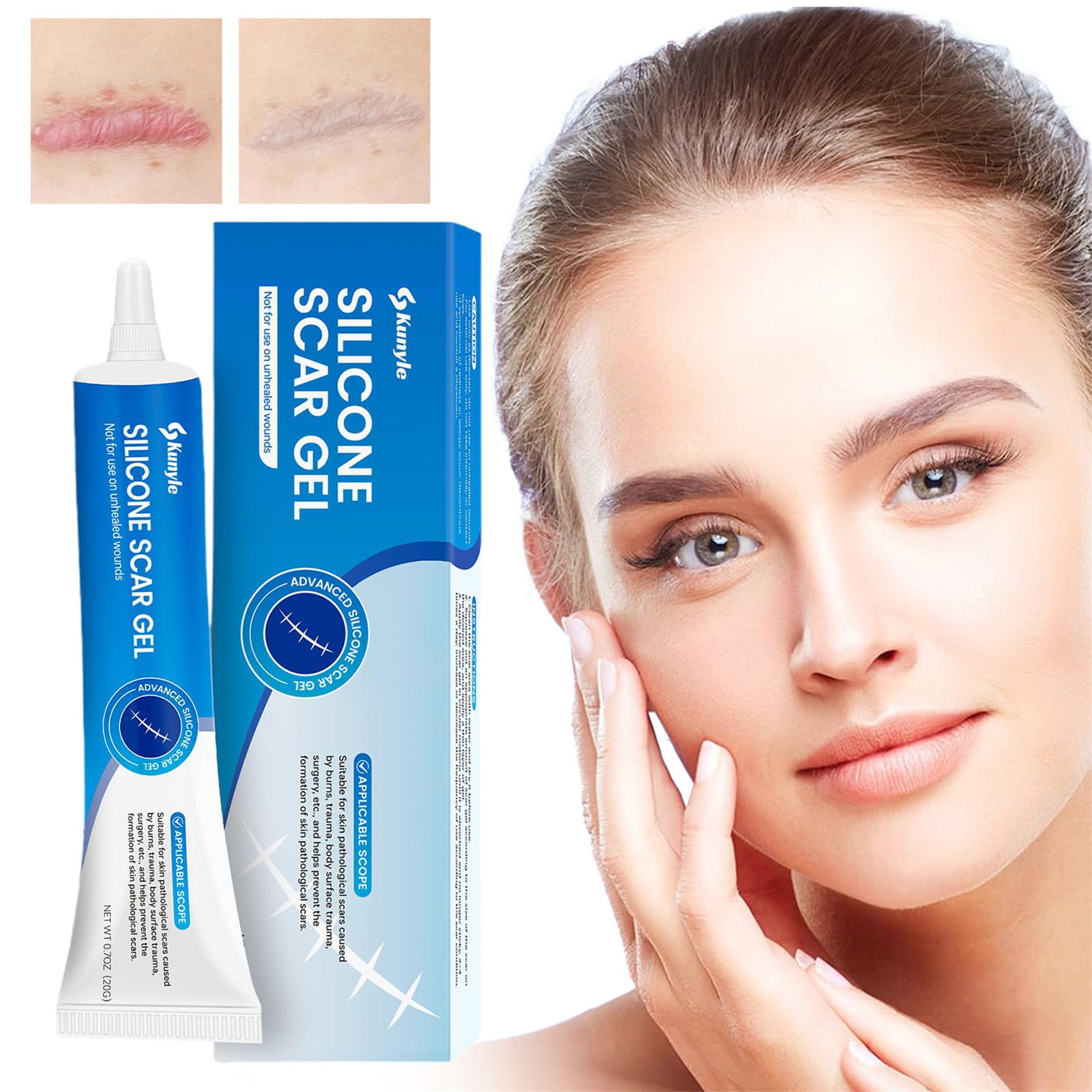 Silicone Scar Gel Scar Cream - Silicone Scar Gel Scar Advanced Scar Gel ...