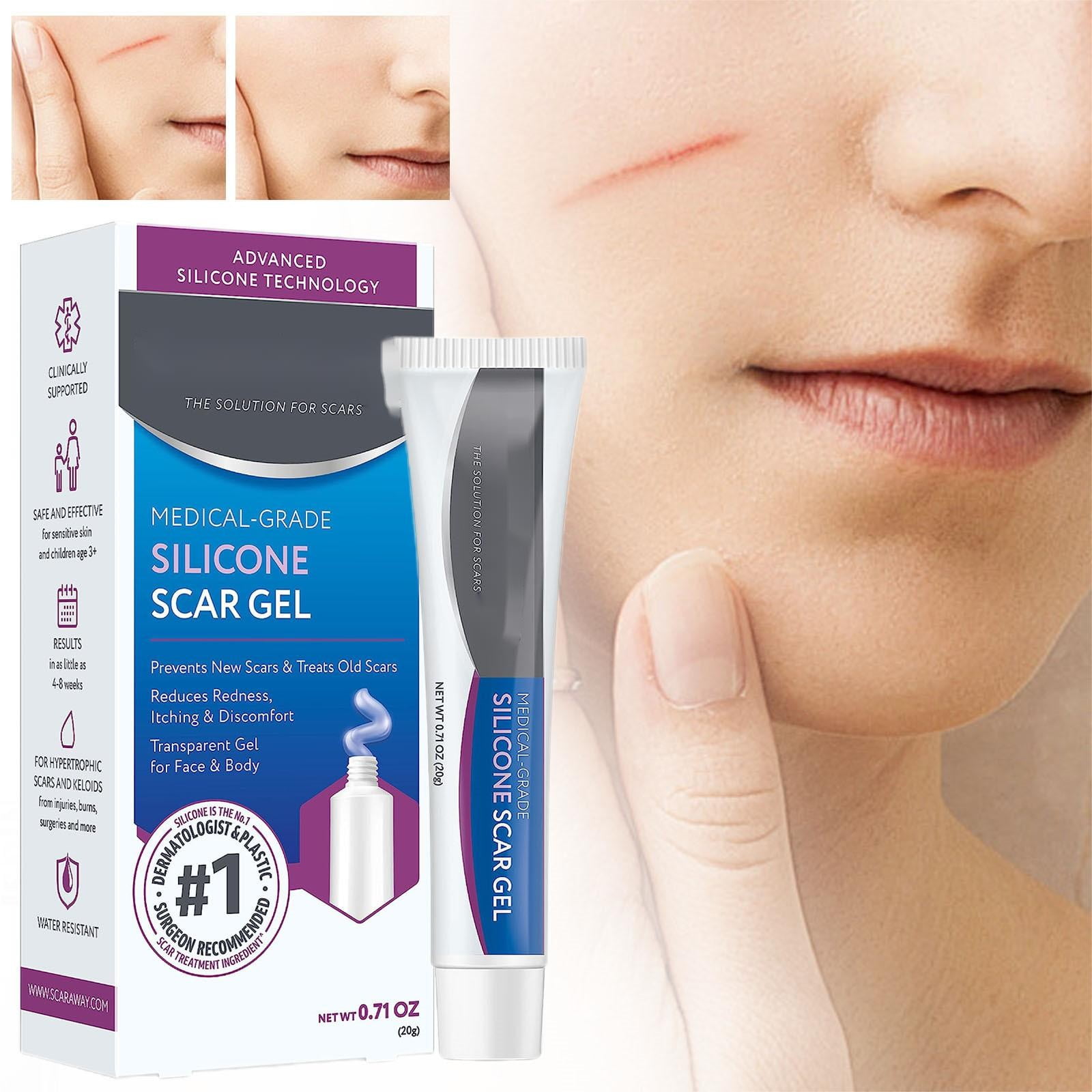 Silicone Scar Gel,Scar Cream For Surgical Scars,Helps Improve Size ...