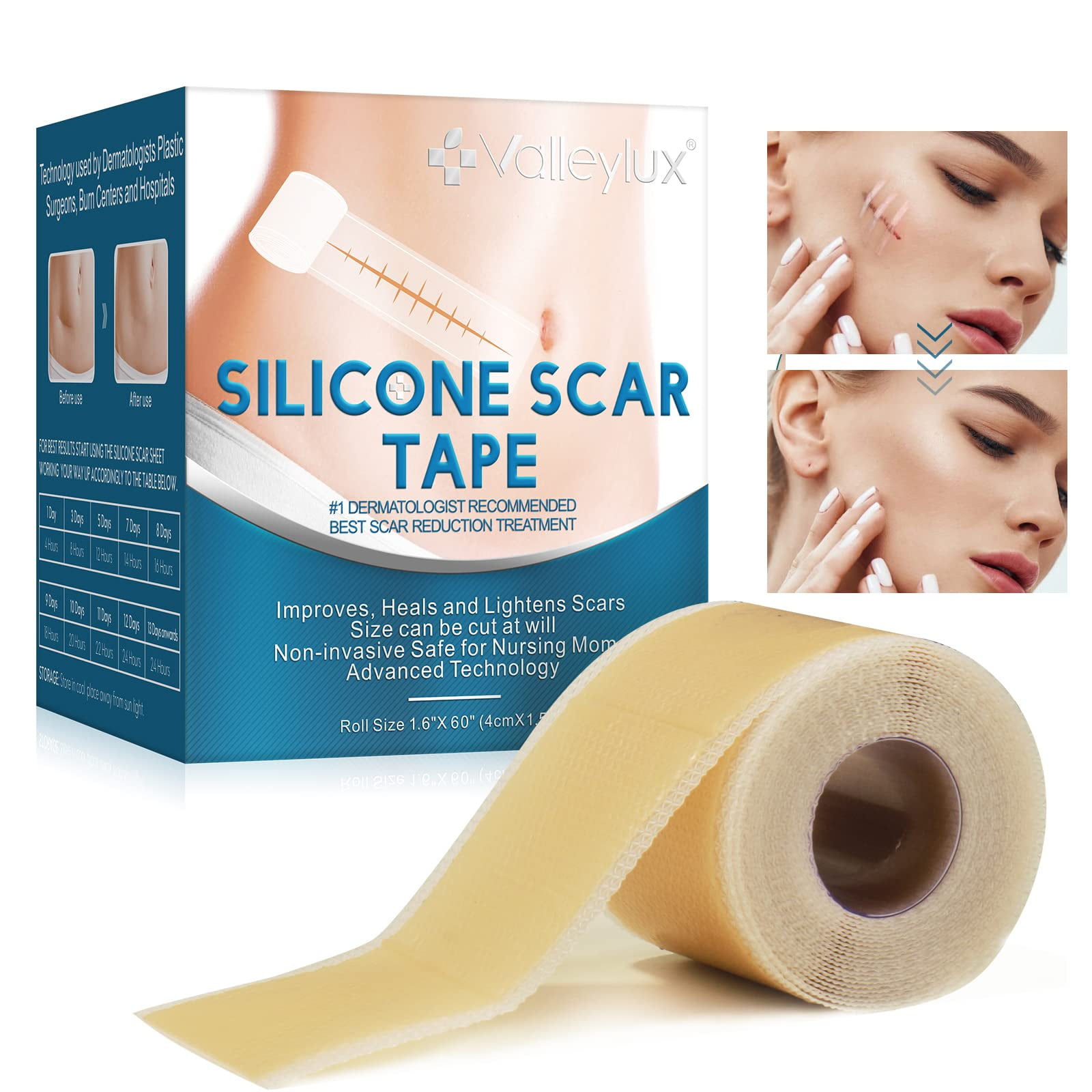 Silicone Scar Tape Roll(1.5M),Medical-Grade MMF7 Silicone Scar sheets ...