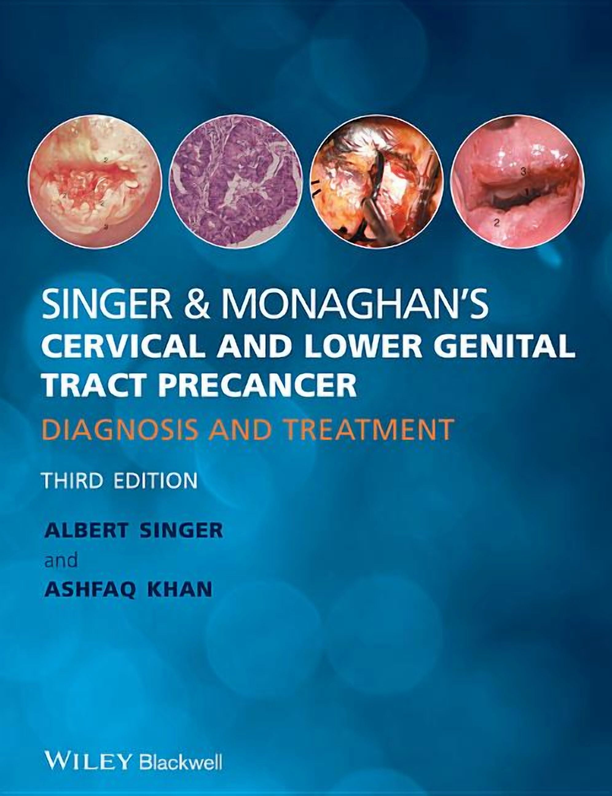 Singer and Monaghan's Cervical and Lower Genital Tract Precancer ...