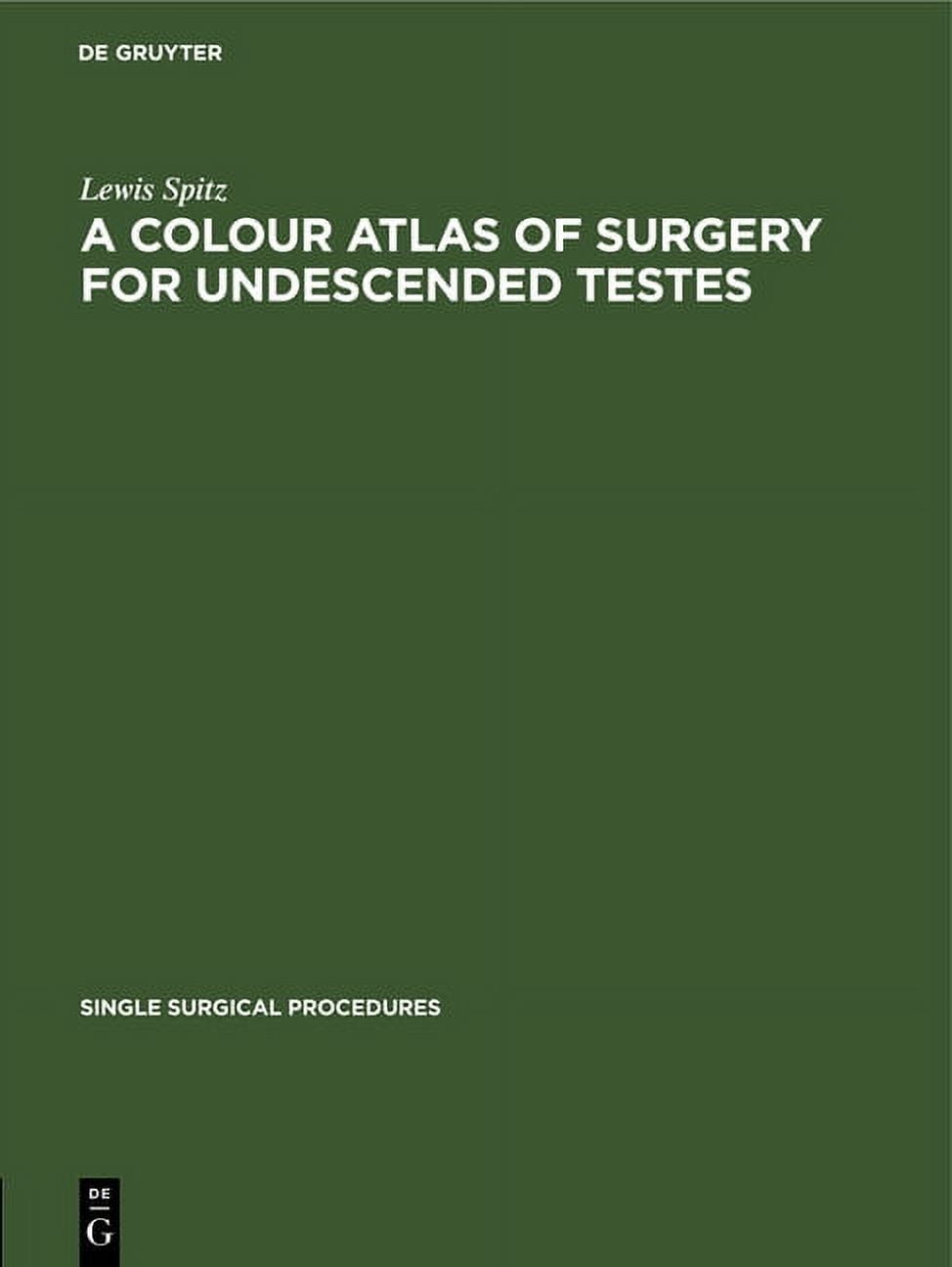 Single Surgical Procedures A Colour Atlas of Surgery for Undescended ...