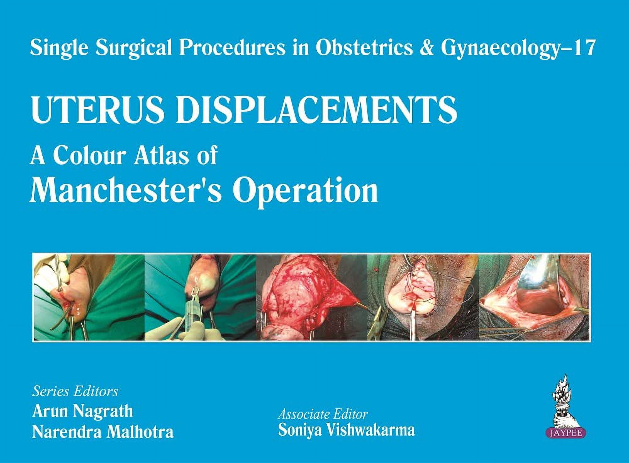 Single Surgical Procedures in Obstetrics & Gynaecology - 17 Uterus ...