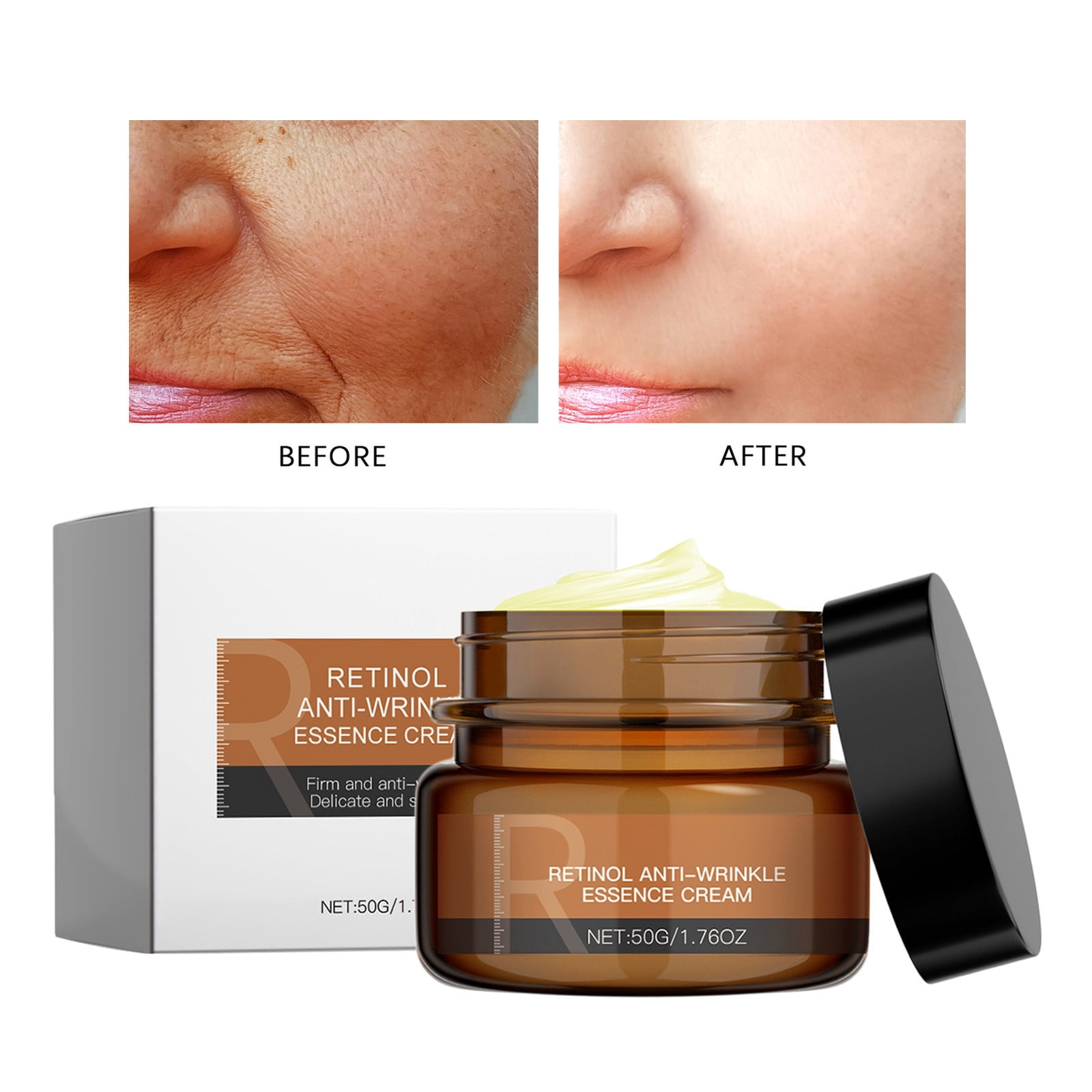 Siquannn Frost Deeply Fine Pimple Popping Kit Teen Skin Care Kits For ...