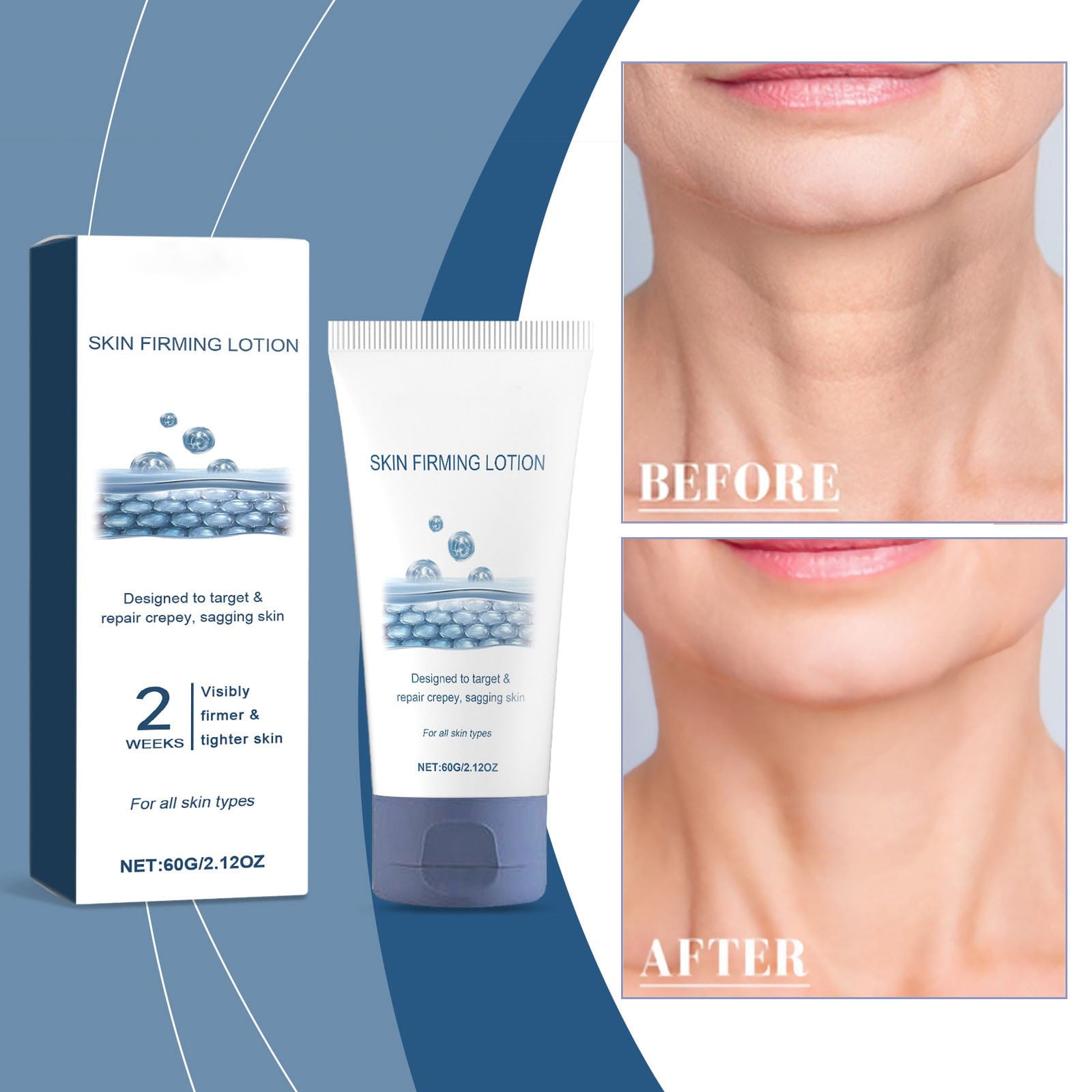 Siquannn Graston Emollient Preppy Skin Moisturizer Sticking Sticks ...