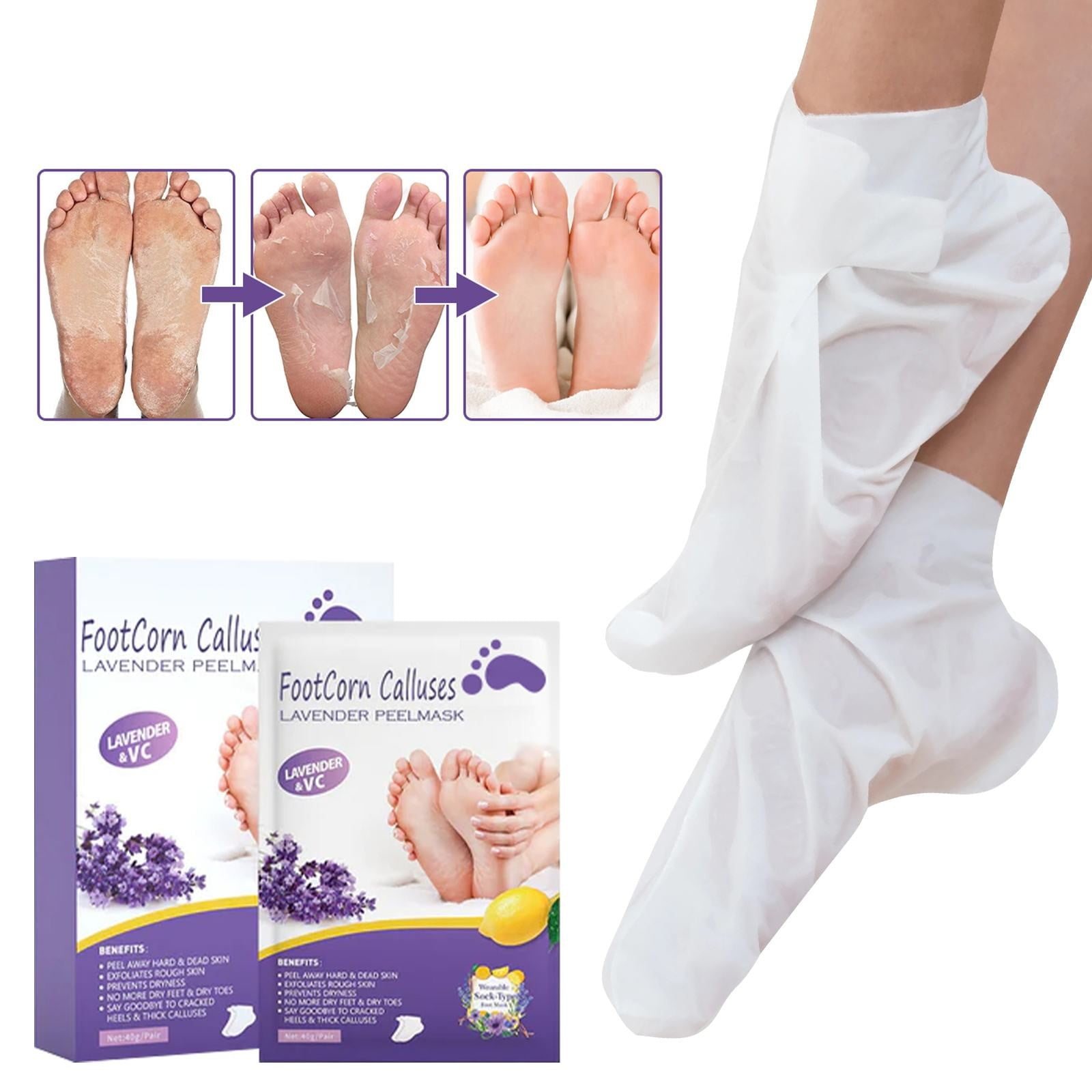 Siquannn Sloughing Lotion for Feet Foot Removal Jelly Spa Feet Dry Skin ... Siquannn Sloughing Lotion for Feet Foot Removal Jelly Spa Feet Dry Skin ...