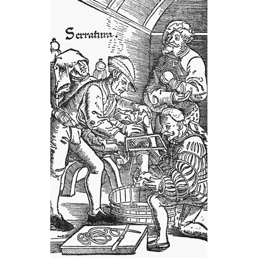 Sixteenth Century Amputation. Poster Print - Walmart.com