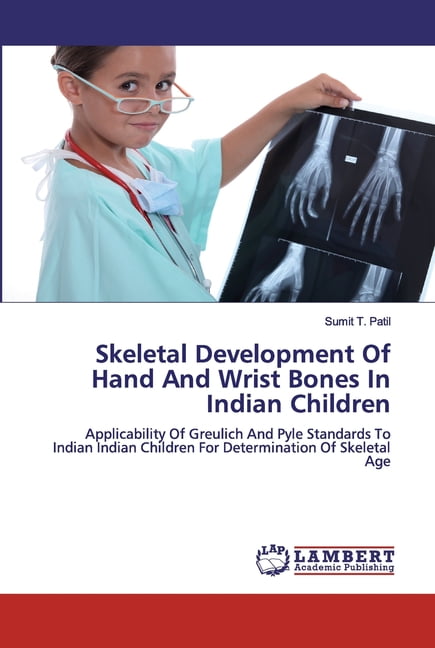 Skeletal Development Of Hand And Wrist Bones In Indian Children ...