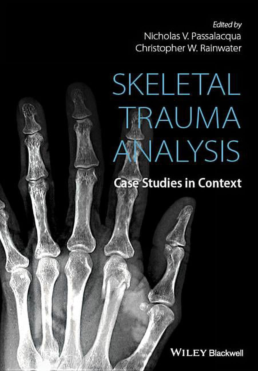 Skeletal Trauma Analysis (Hardcover) - Walmart.com Skeletal Trauma Analysis (Hardcover) - Walmart.com