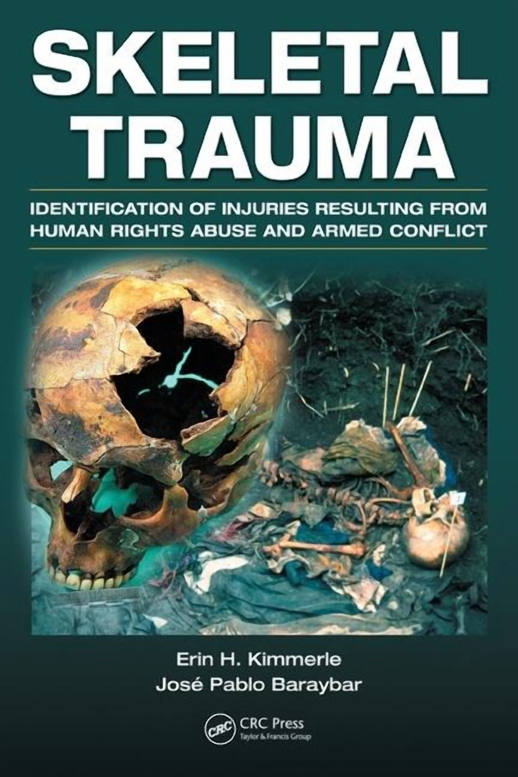 Skeletal Trauma: Identification of Injuries Resulting from Human Rights ...
