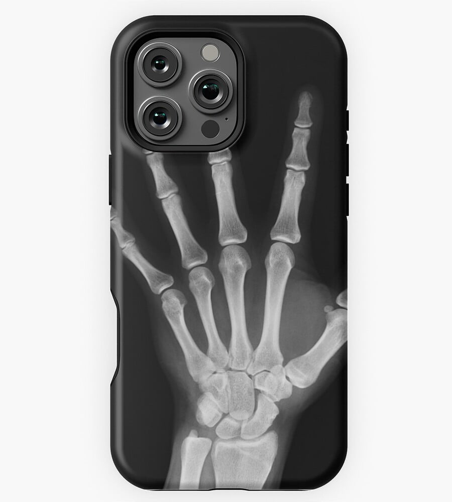 Skeletal hand GA5598 Phone Case for iPhone 11 to 17 Pro Max - Walmart.com