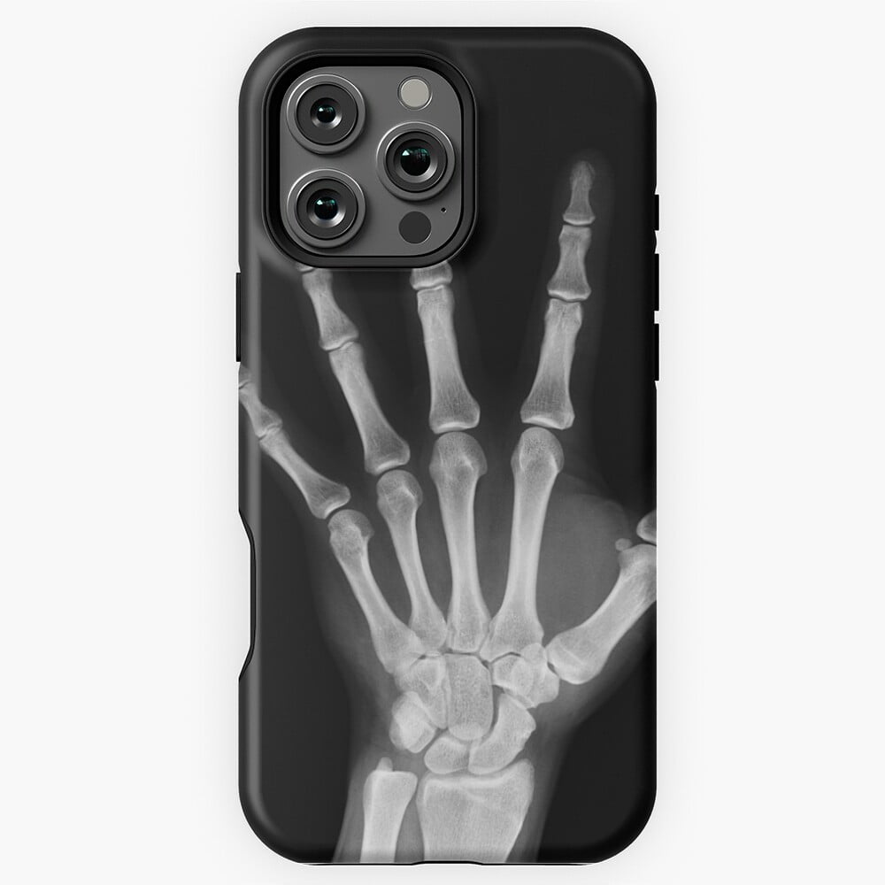 Skeletal hand Phone Case for iPhone 16 15 14 13 12 11 Pro Max M5904352 ...