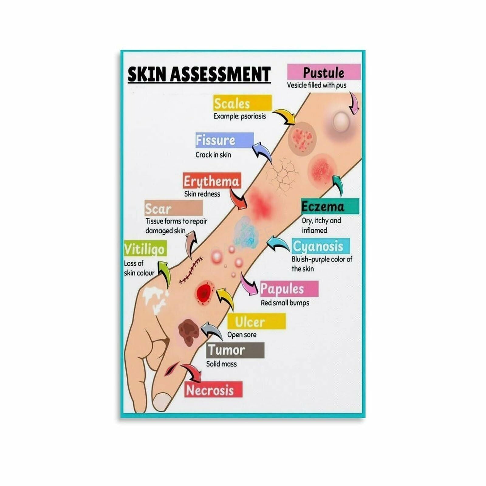 Skin Assessment Wound First Aid Knowledge Poster Canvas Painting ...