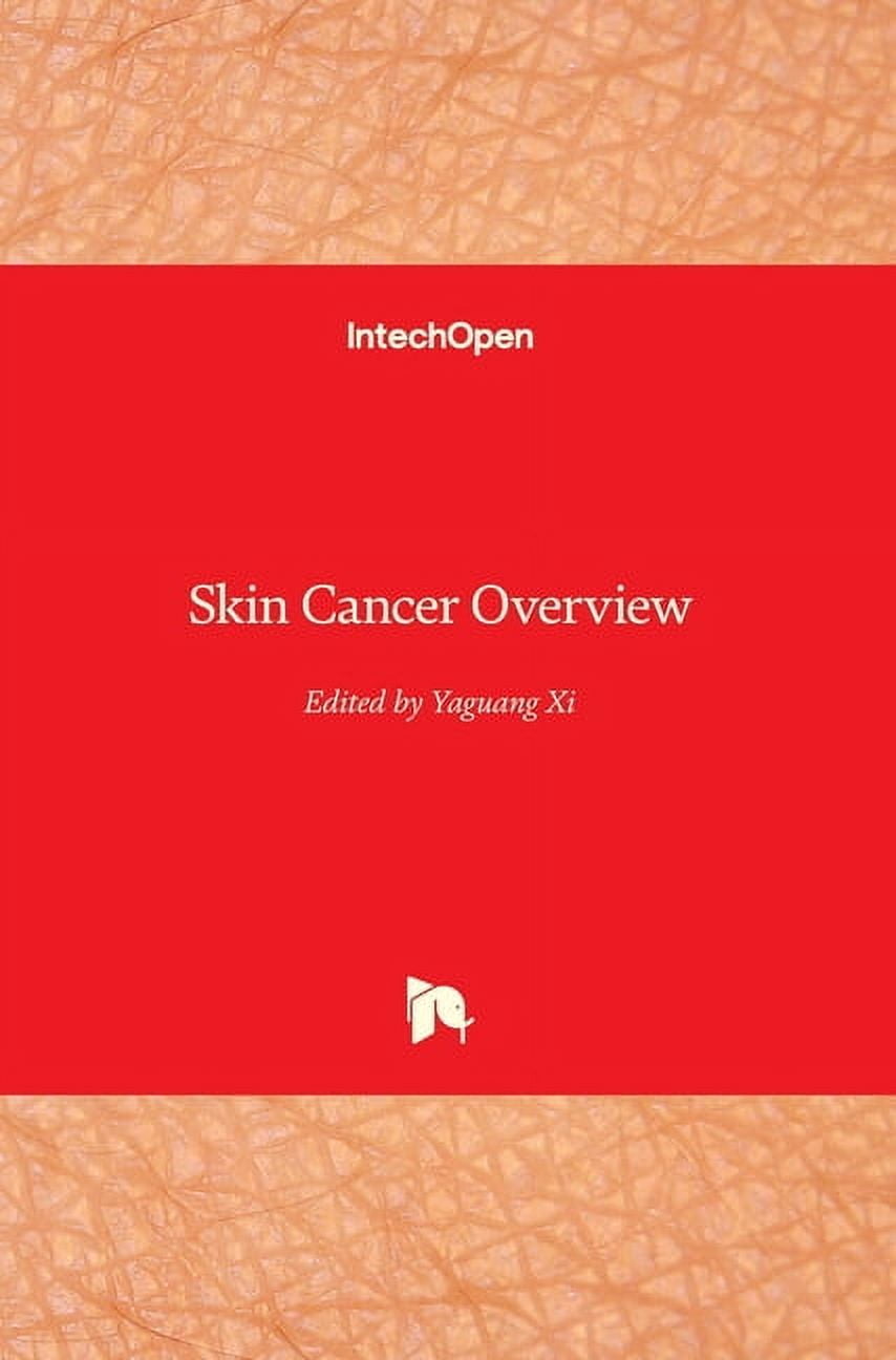 Skin Cancer Overview (Hardcover) - Walmart.com