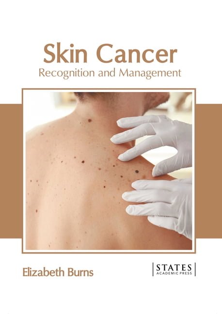 Skin Cancer: Recognition and Management (Hardcover) - Walmart.com