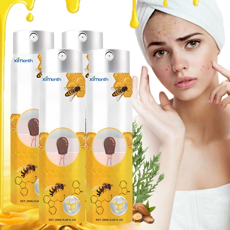 Skin Cleansing Mist - Salicylic Acid Skin Spray, containing glycerin ...