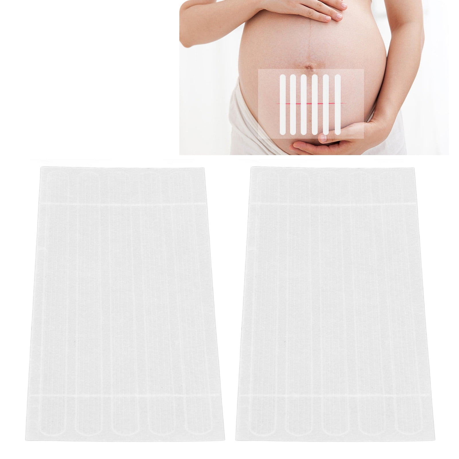 Skin Closure Strip,ANGGREK Skin Closure Tape Children Adult Adhesive ...