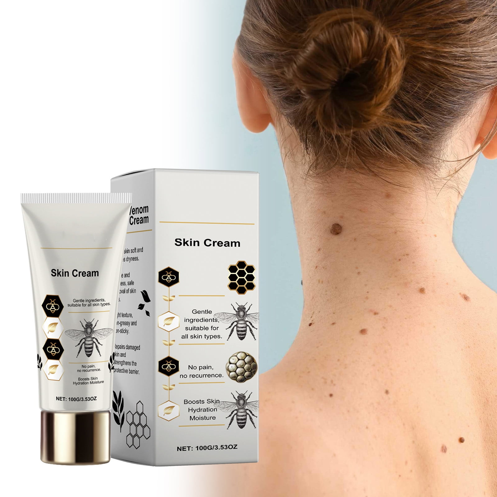 Skin Cream For Skin Tags Ease Skin Tags And Warts Ease Skin Itching And ...