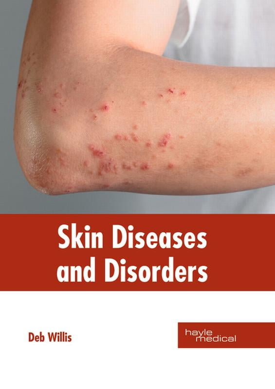 Skin Diseases and Disorders, (Hardcover) - Walmart.com