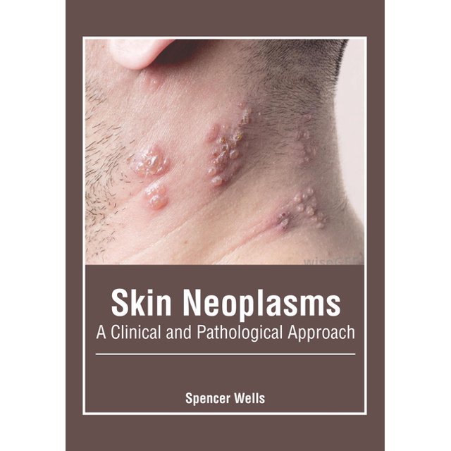 Skin Neoplasms: A Clinical and Pathological Approach (Hardcover ...