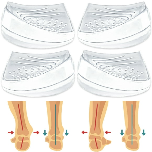 Supination Insoles