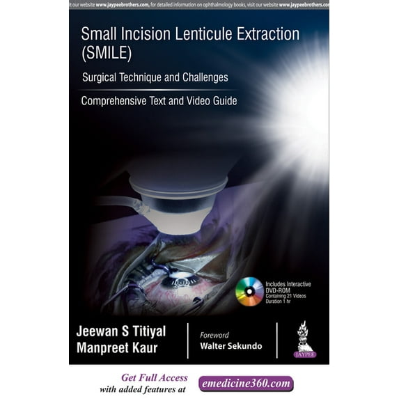 Small Incision Lenticule Extraction (SMILE) : Surgical Technique and ...