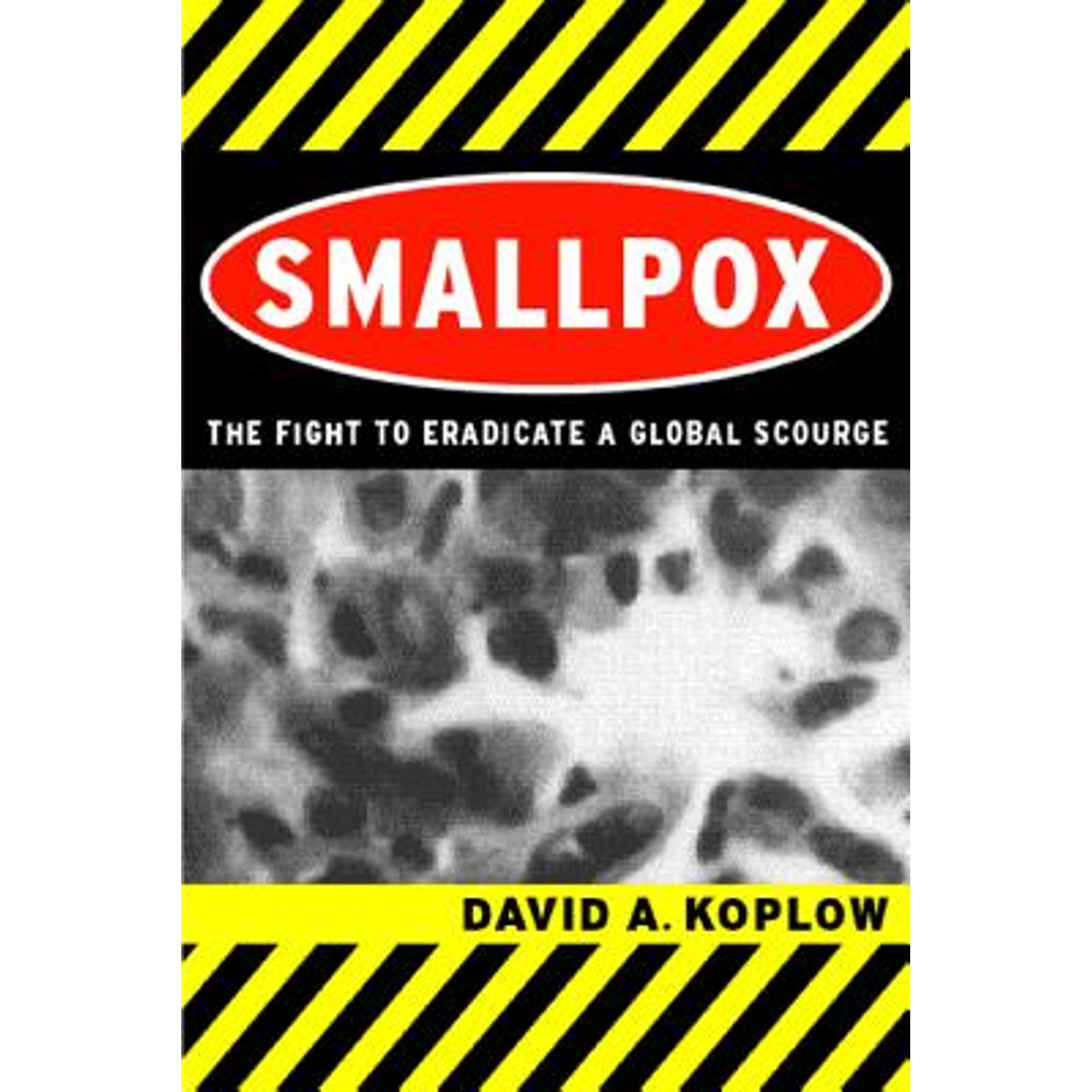 Pre-Owned Smallpox: The Fight to Eradicate a Global Scourge (Paperback ...