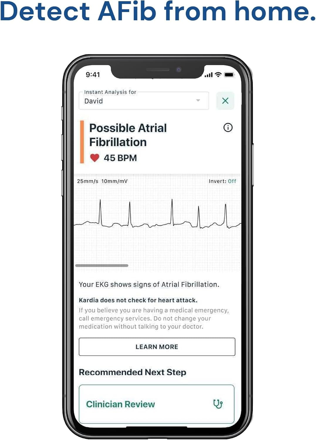Smart Heart Monitor with Instant Results - Walmart.com