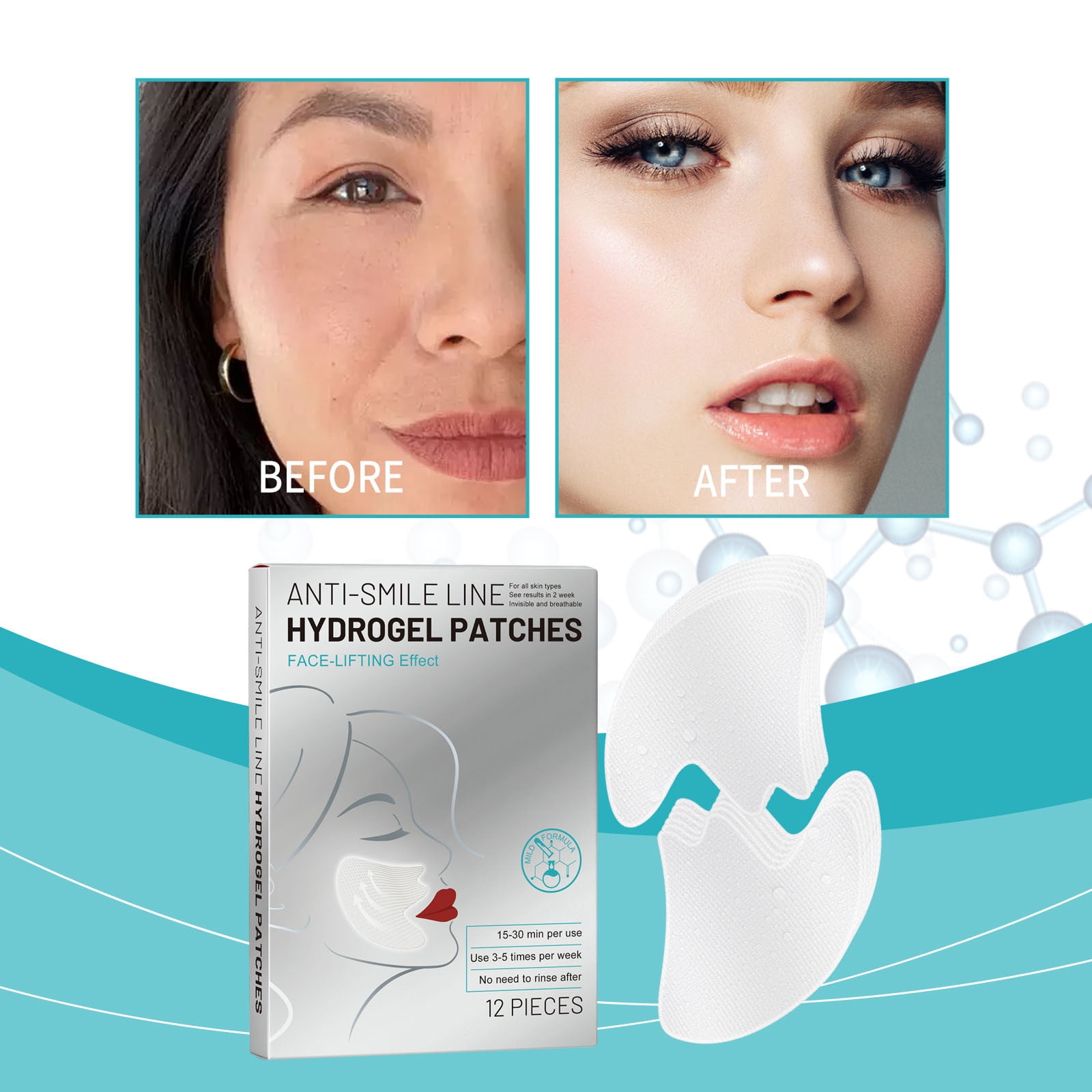 Smile Line Patches (12 pcs), Nasolabial Folds & Laugh Line Patches ...