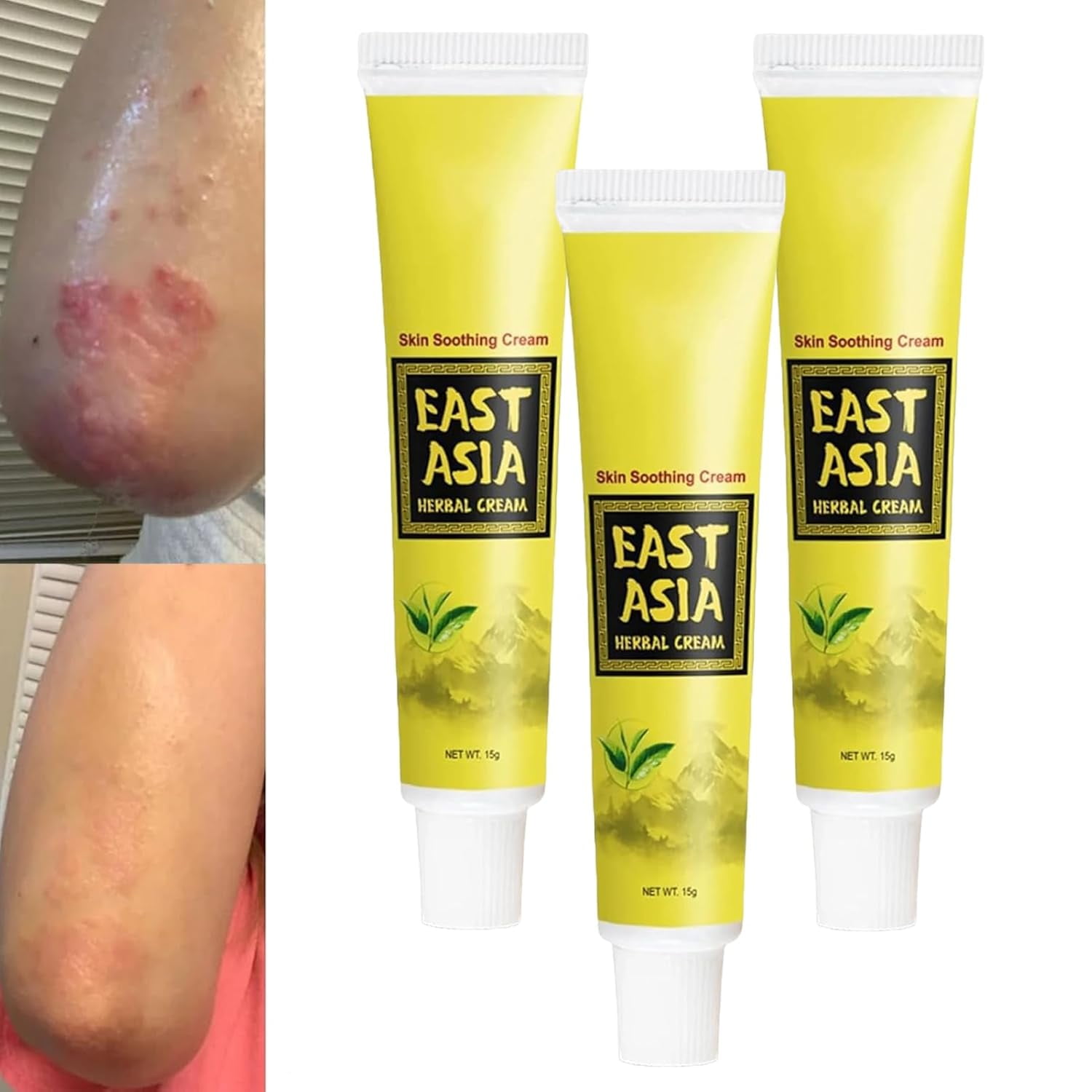 Smiles and Joys Herbal Cream, East Asian Natural Herbal Cream, Herbals ...