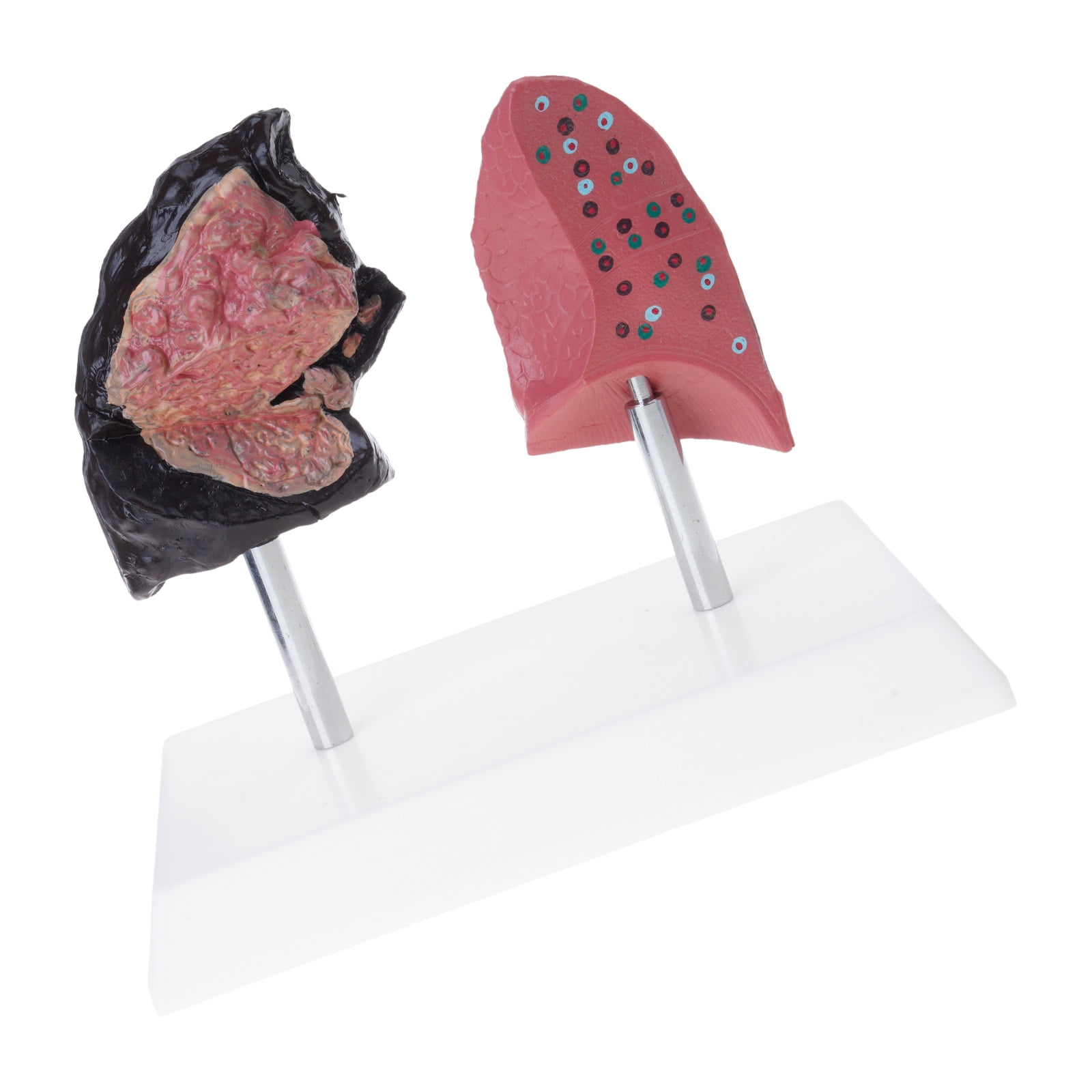 Smoker Lung And Healthy Lung Anatomical Model For Teaching PVC ...