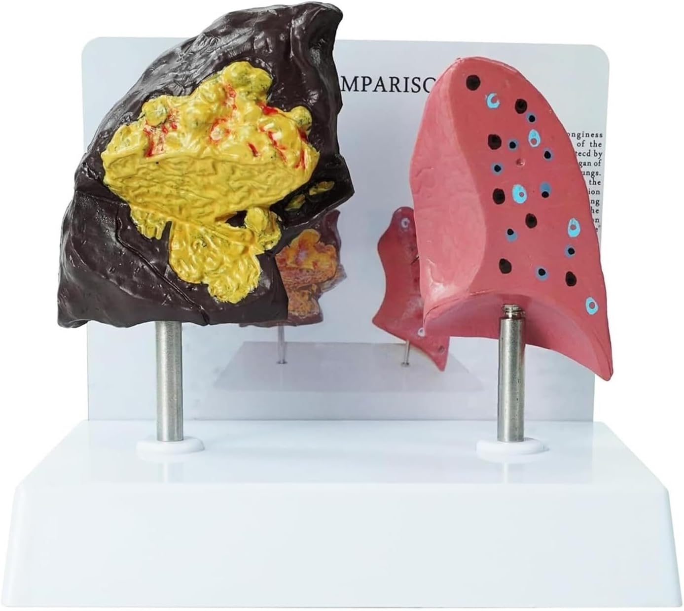 Smoker Lung Model+Healthy Lung Model, 1:1 Life Size 3D Model, with ...