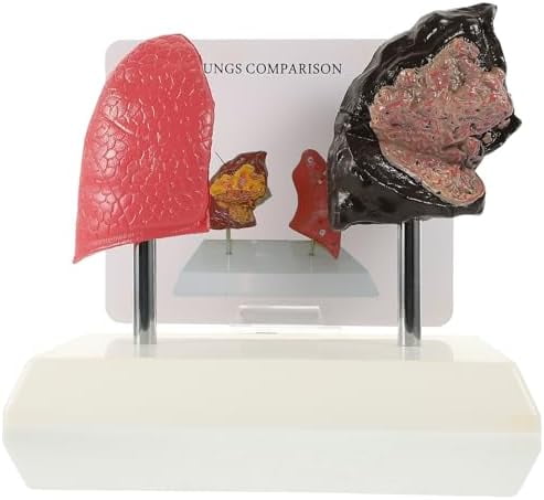 Smoking and Normal Lung Comparison Model, Medical Teaching Tool for ...