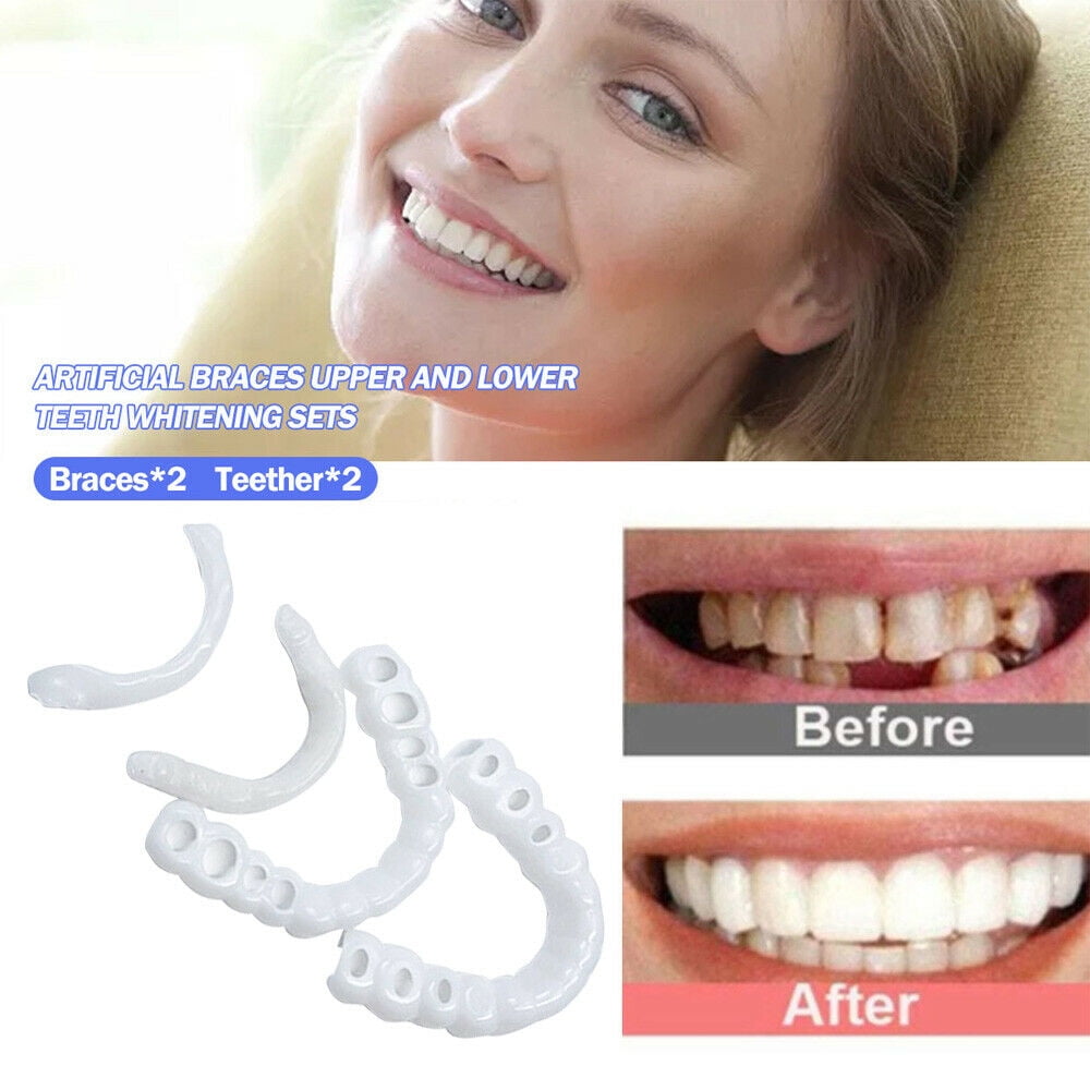 Snap On Upper & Lower False Teeth Dental Veneers Nepal | Ubuy