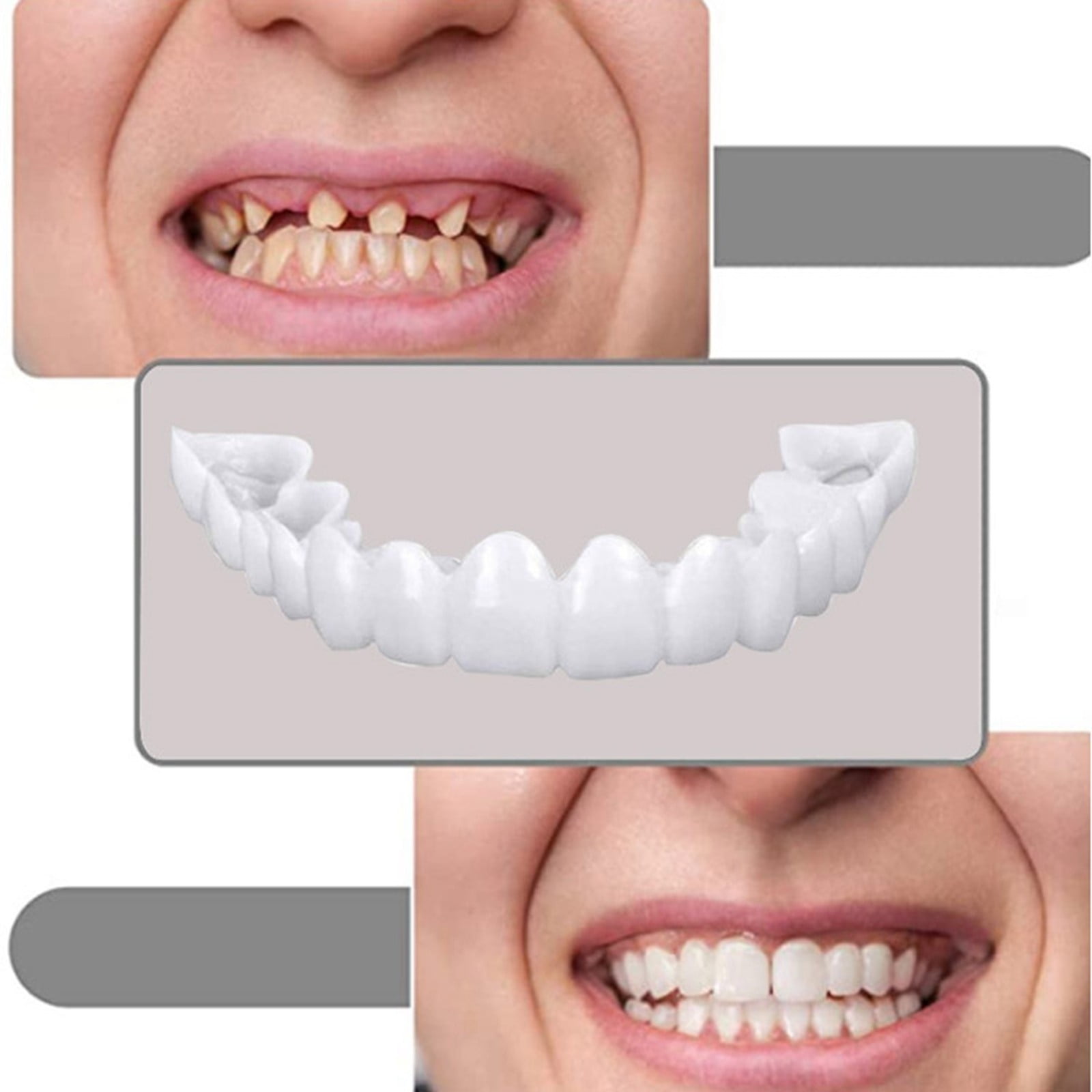 Snap on Veneers - Moldable False Teeth, Replacement Kit for Missing ...