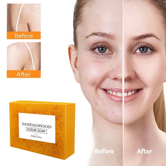 Soap Lemon Turmeric Soap Tablets Cleansing Turmeric Soap Facial And ...