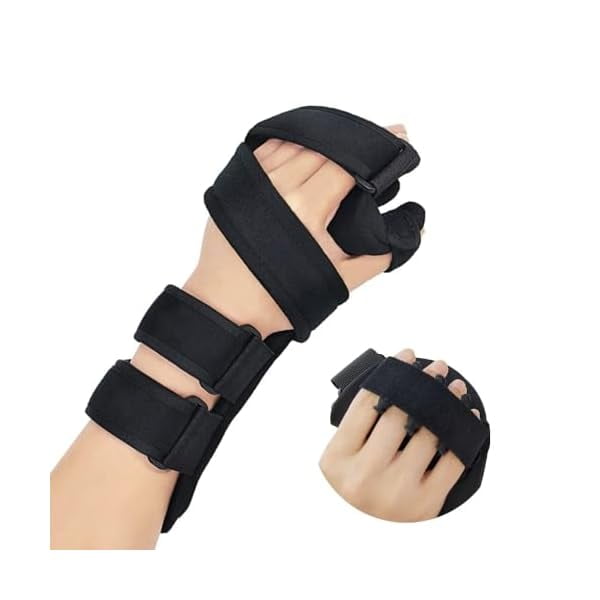Soft Functional Resting Hand Splint for Flexion Contractures - Stroke ...