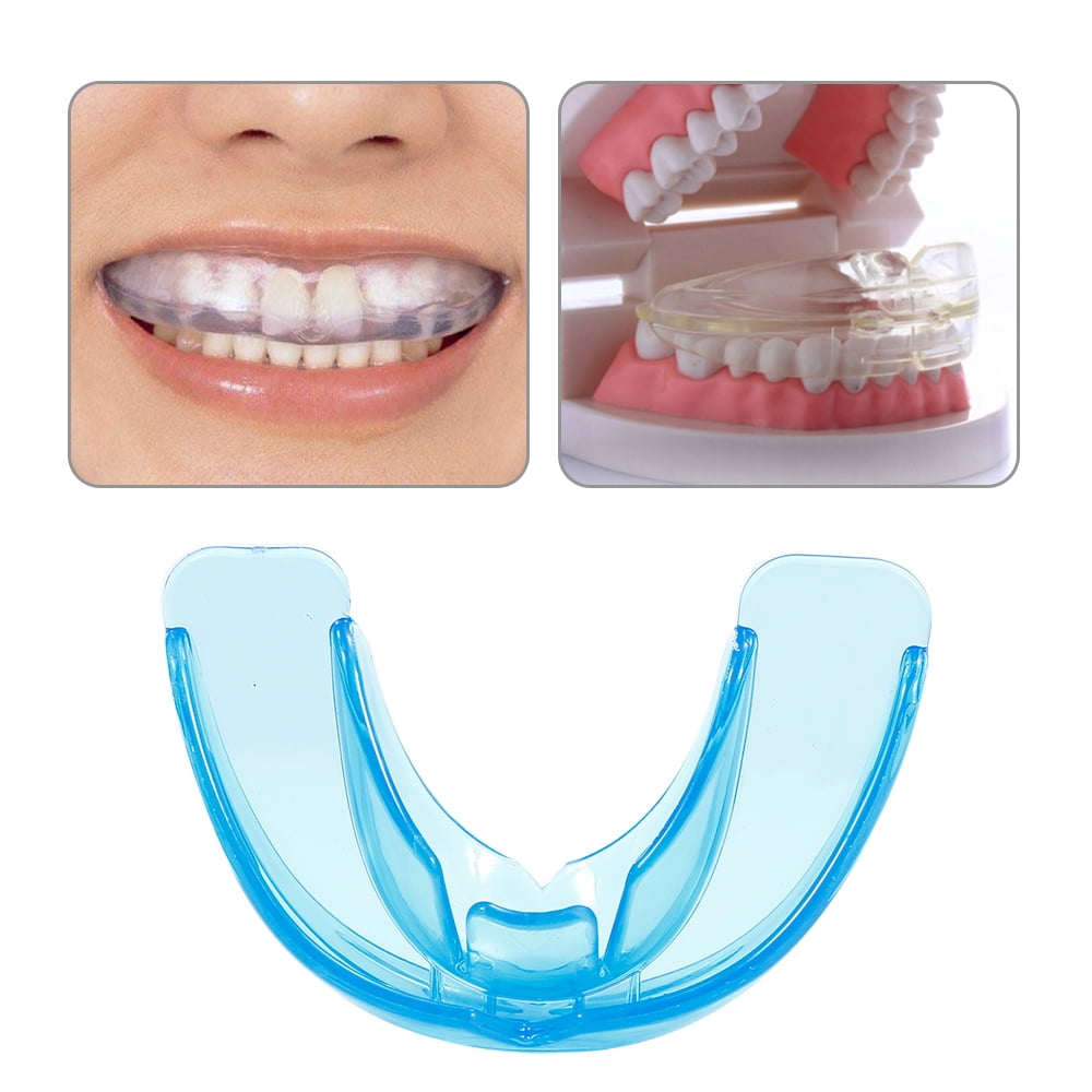 Retainer For Missing Teeth